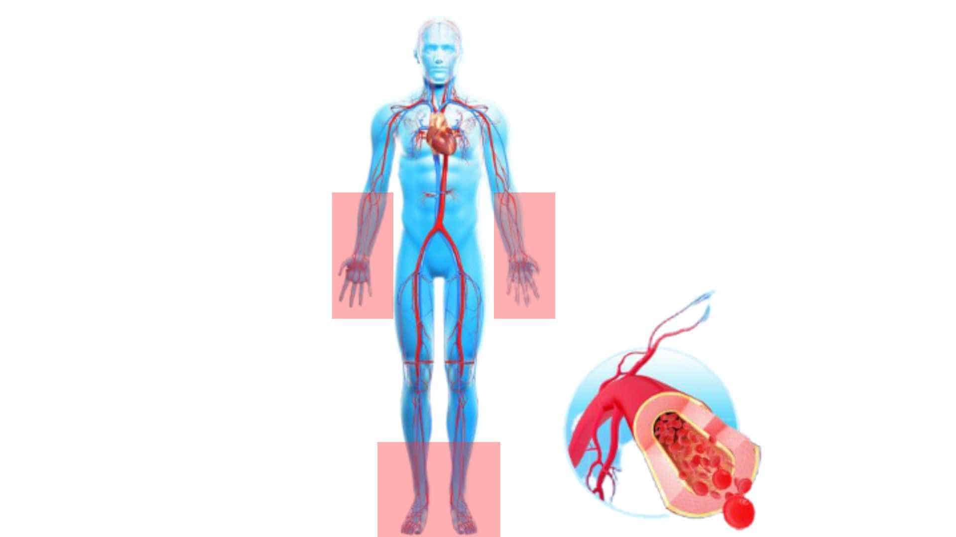 Why do diabetics have poor circulation? - Health solution blog